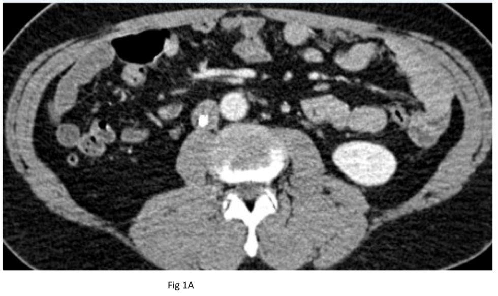 Vein Specialist AVF Newsletter — September 2022 | American Venous Forum
