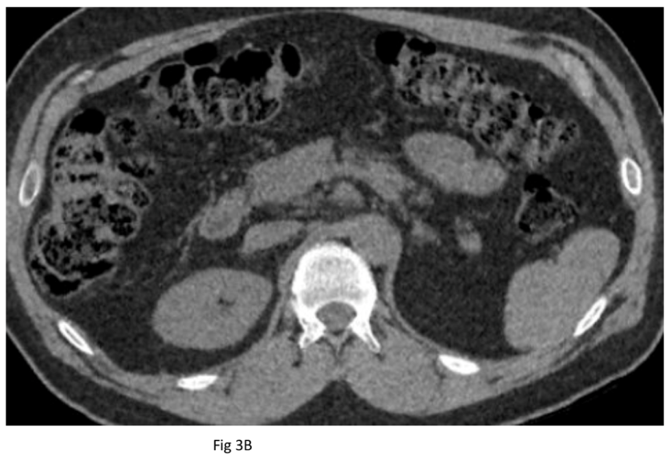 Vein Specialist AVF Newsletter — September 2022 | American Venous Forum