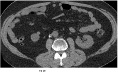 Vein Specialist AVF Newsletter — September 2022 | American Venous Forum